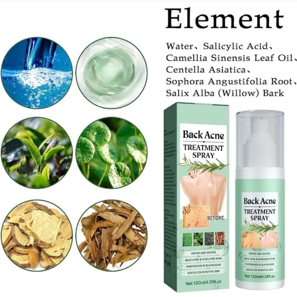 Skincare | Nwtnwt 2pcs Back Acne Treatment Back Acne Spray 2 Salicylic ...